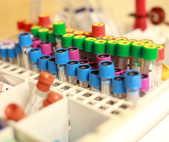 Laboratory Services - Stevens Community Medical Center Services